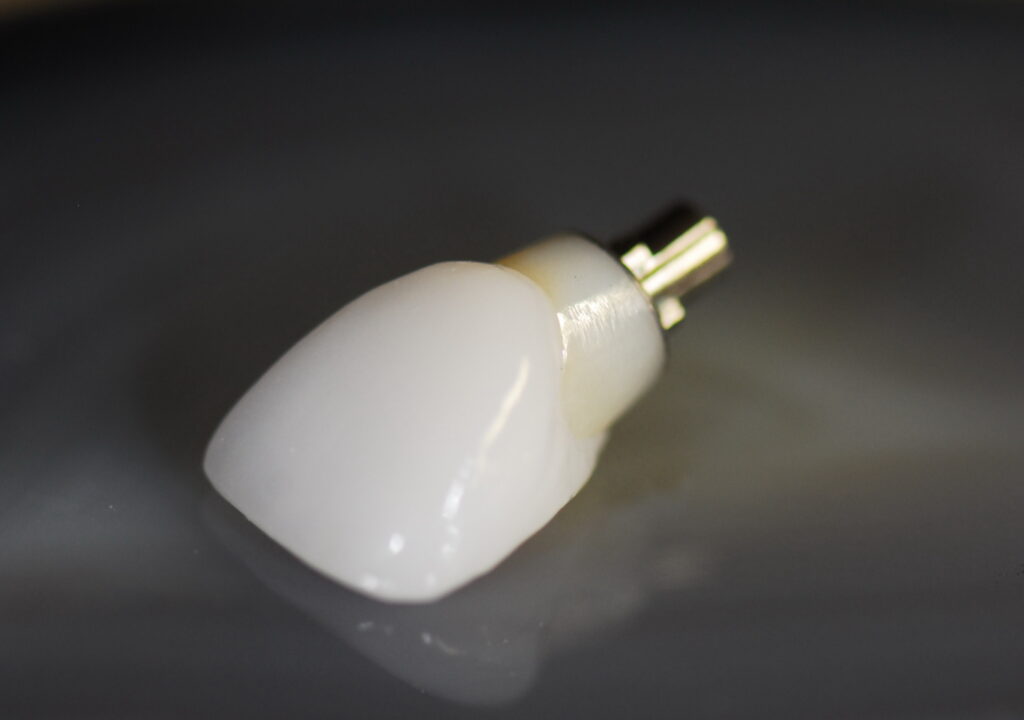 Products - Nu Smile Dental Lab